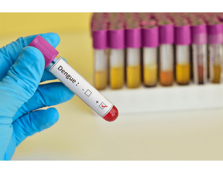 Correlation of CBC parameters with intestinal parasites infections | Boule